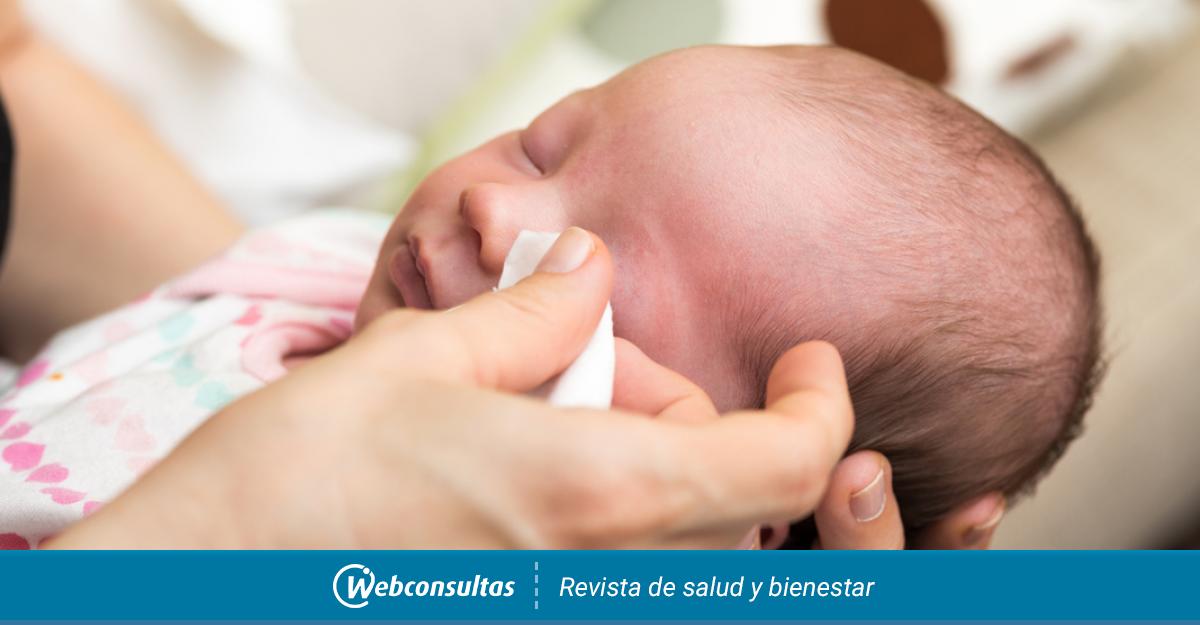 Profilaxis Ocular En El Bebé Para Evitar Conjuntivitis Neonatal